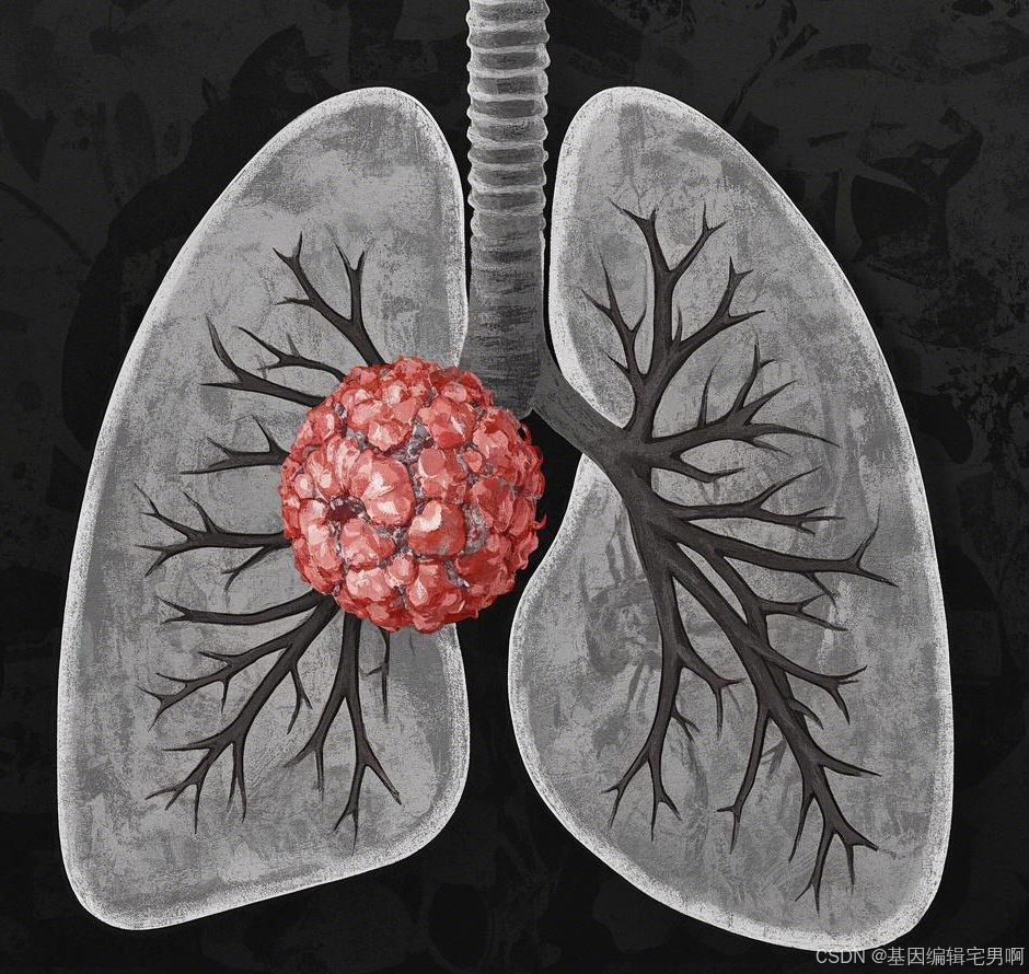 临床试验100问——什么是非小细胞癌？_hypoxia studies in non鈥憇mall cell lung cancer: pat-CSDN博客