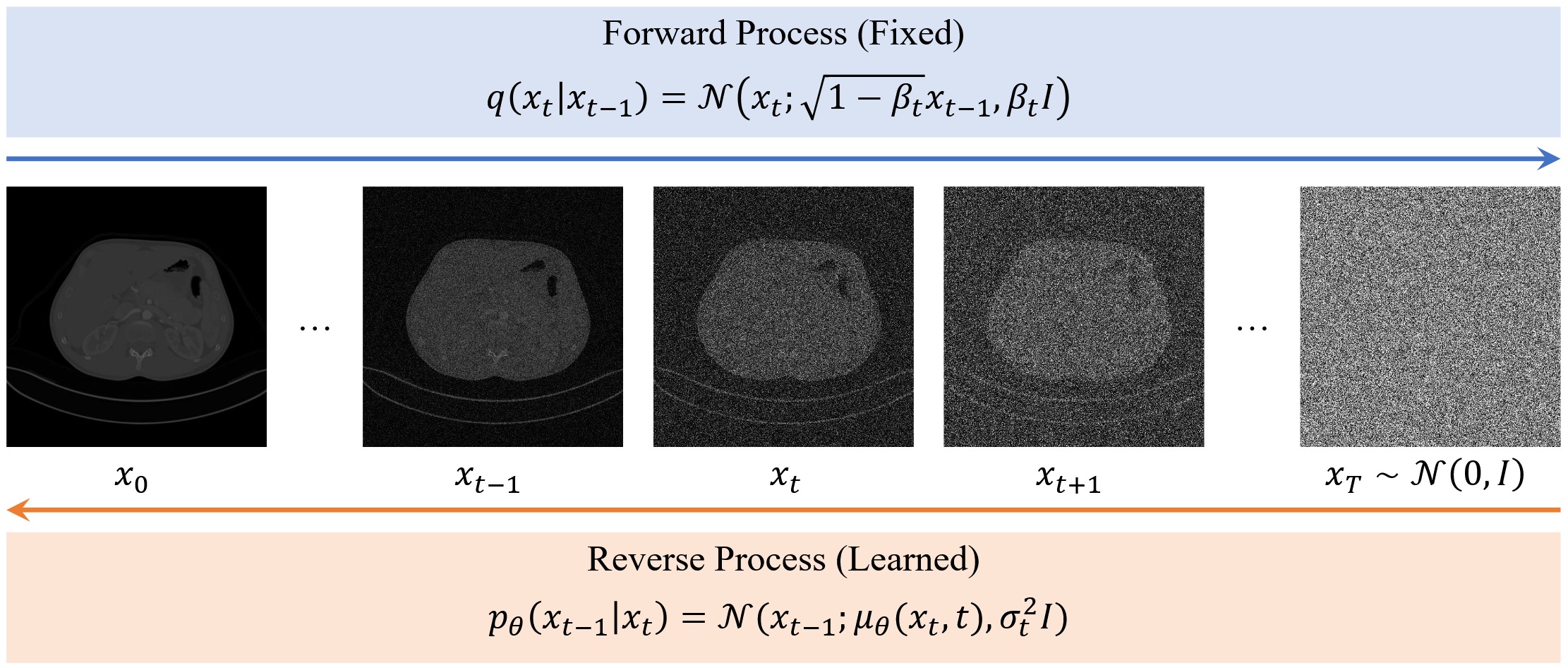 【MAR】Unsupervised CT Metal Artifact Reduction by Plugging Diffusion Priors in Dual Domains-CSDN博客