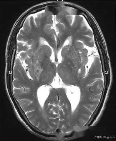 傻瓜式ImageJ可训练的图像分割_imagej weka-CSDN博客