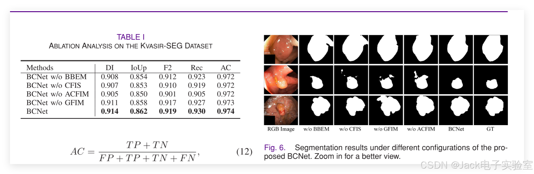 【论文阅读】BCNet Boundary Constraint Network With Cross Layer Feature Integration for Polyp ...