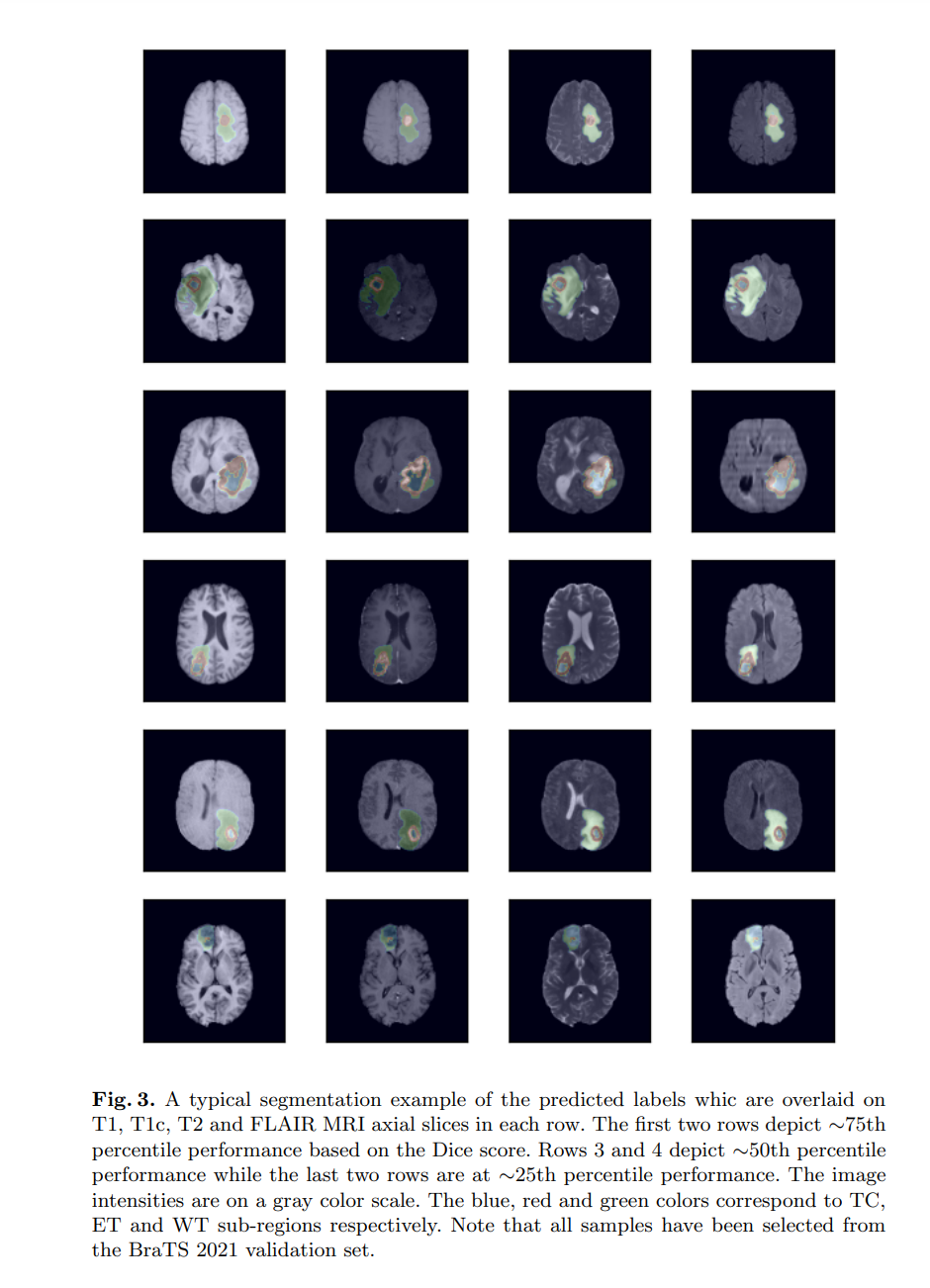 【SwinUNETR】《Swin UNETR: Swin Transformers for Semantic Segmentation of Brain Tumors in MRI...》译读 ...