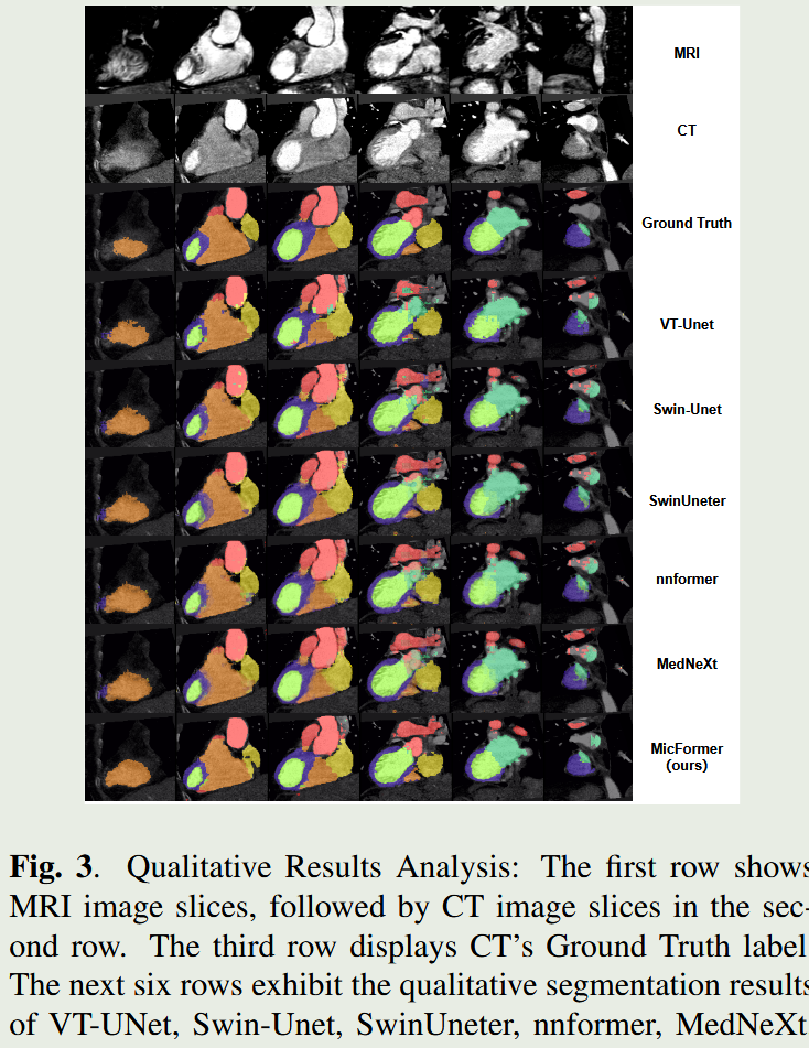 多模态信息交互分割 MULTIMODAL INFORMATION INTERACTION FOR MEDICAL IMAGE SEGMENTATION.-CSDN博客