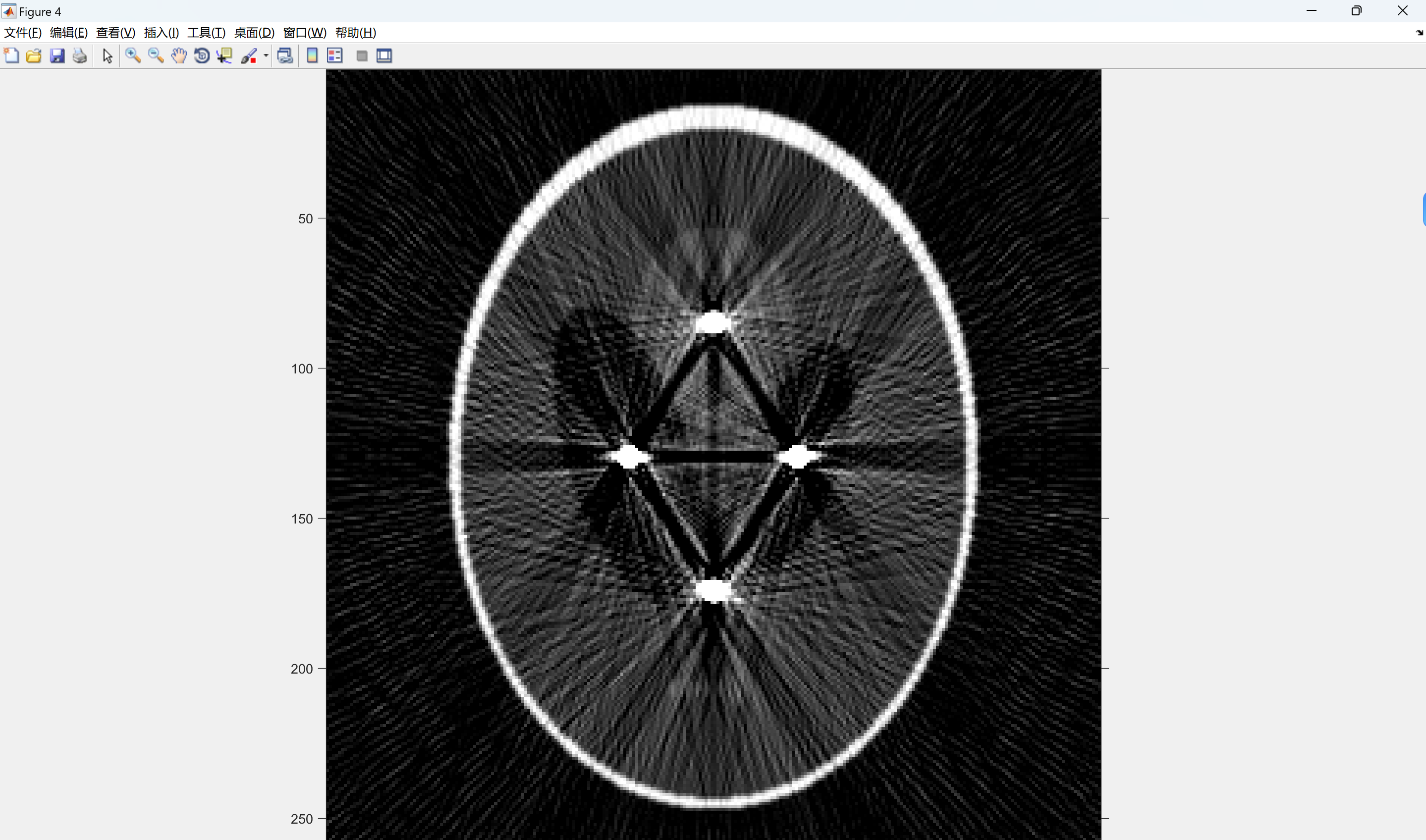 【创建计算机断层扫描金属制品】创建的计算机断层扫描金属伪影、该模拟为平行束CT（Matlab代码实现）-CSDN博客