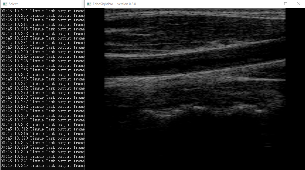 免费实时 超声软波束 框架 EchoSight-Pro发布页面_csdn echo sight-CSDN博客