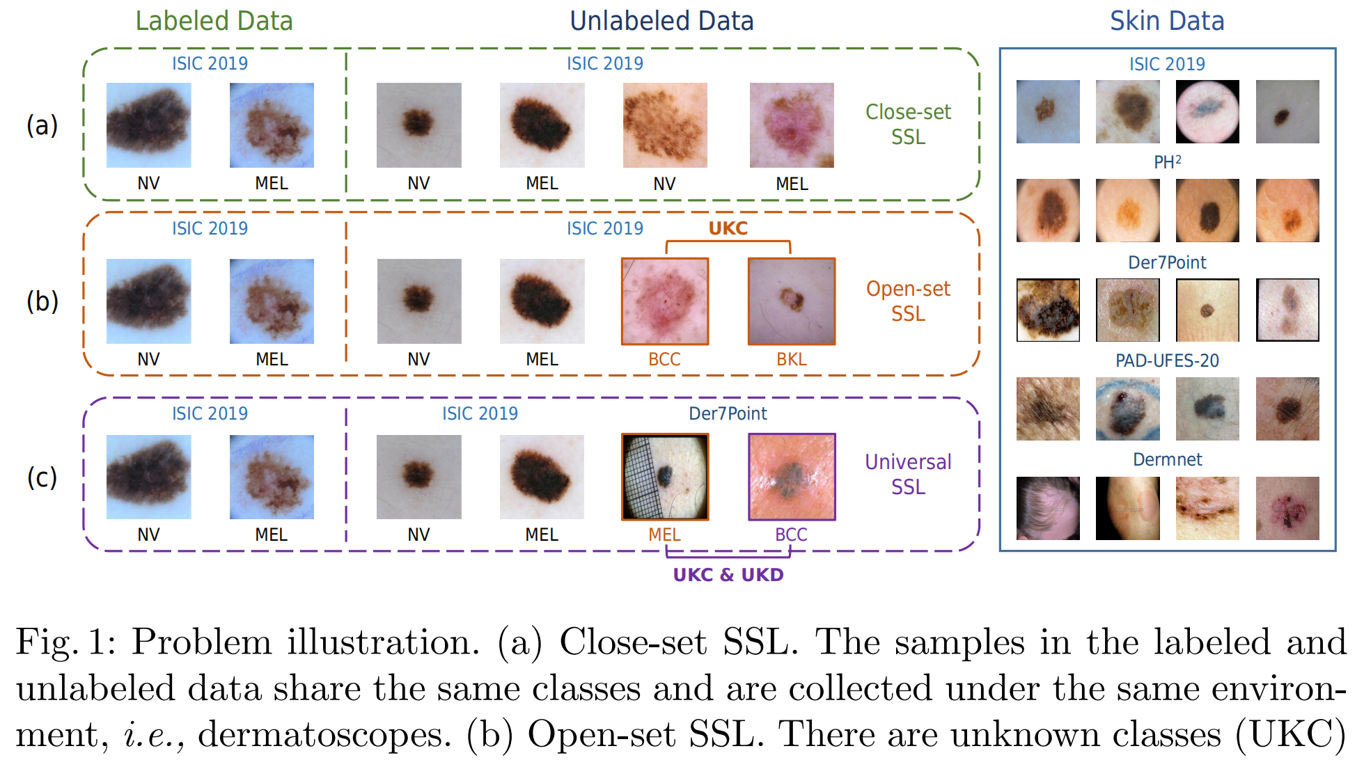 MICCAI‘24 | 基于普适半监督学习的医学图像分类_universal semi-supervised learning for medical ima-CSDN博客