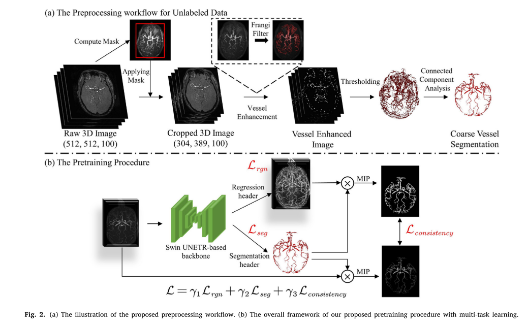 Benefit from public unlabeled data: A Frangi filter-based pretraining ...