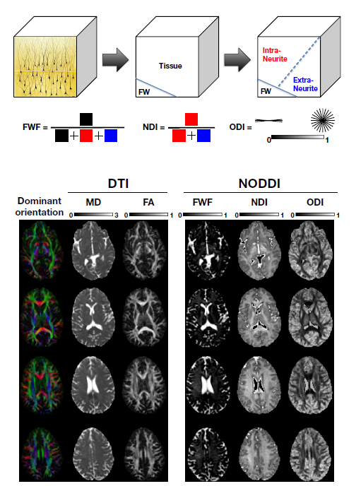 神经突定向弥散与密度成像（NODDI）：精神疾病微观脑结构研究的新利器_noddi能进行概率性纤维束分析吗-CSDN博客