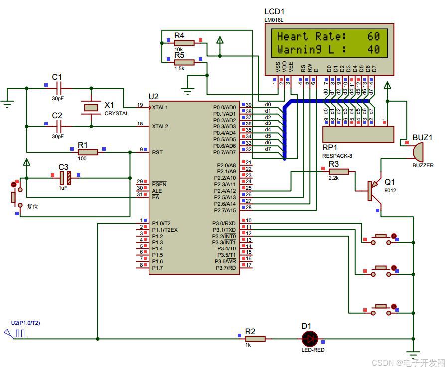 基于单片机的心率监测系统设计 (电路+仿真+程序+论文)(51+1602+ST188+LM358+BZ+KEY3) 0403_基于单片机的心率 ...