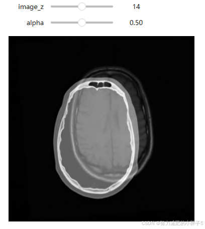 simpleITK - Registration - SimpleITKv4配准简介_simpleitk图像配准-CSDN博客