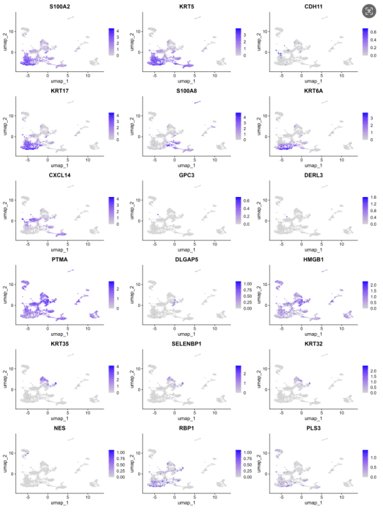 【R语言】单细胞——单个样本分析流程(1)_r语言单细胞数据细胞聚类-CSDN博客