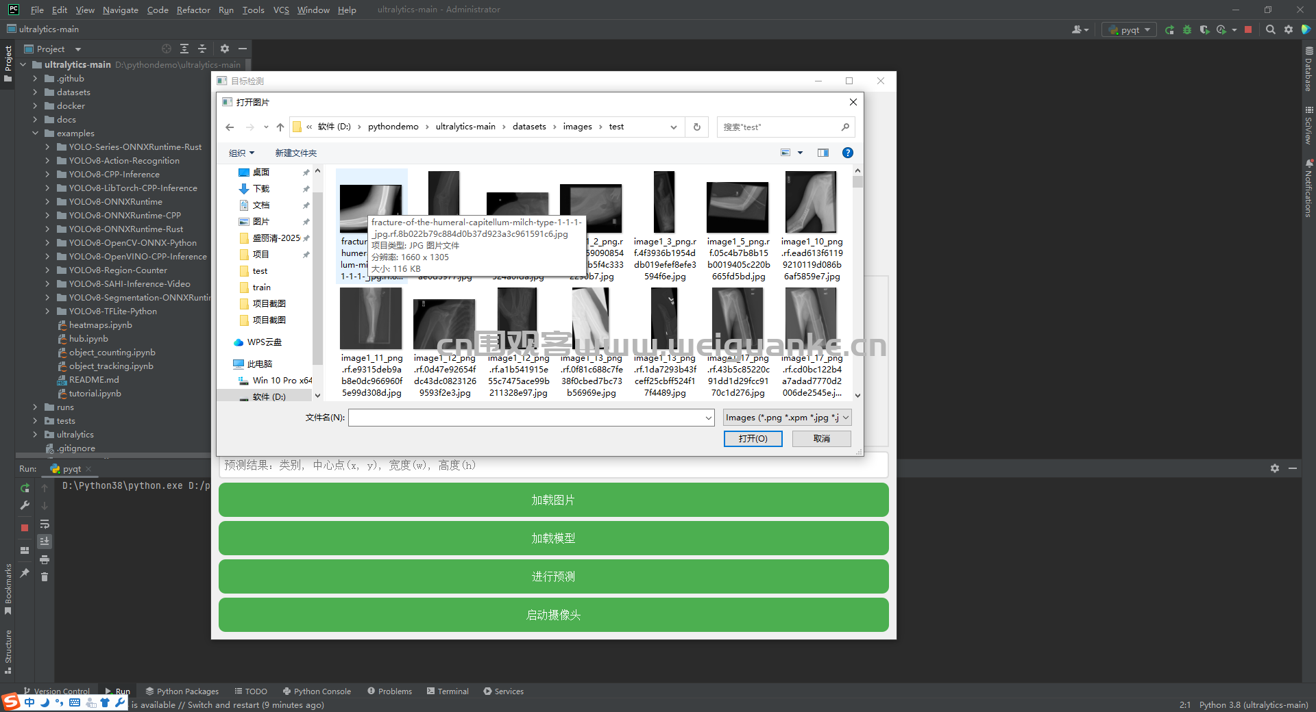 骨折识别及定位系统-python+yolo8_骨折智能识别系统-CSDN博客