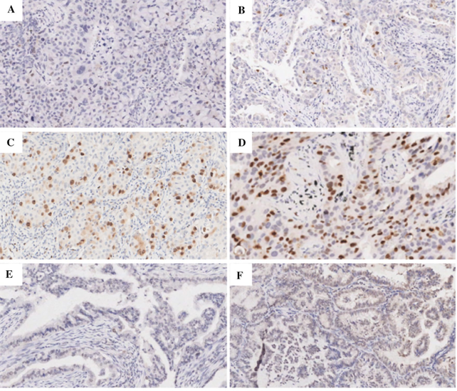 免疫组化与HE染色结果怎么看？_he染色 知乎-CSDN博客