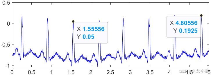 信号与系统工程实践--ECG（心电图）_ecg信号-CSDN博客