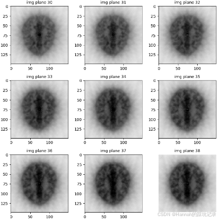 手把手Parallelproj重建PET hoffman数字体模(sinogram MLEM重建)-CSDN博客