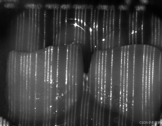 口内牙齿扫描，线激光中心提取，改进的steger算法（2）_线激光提取图片-CSDN博客