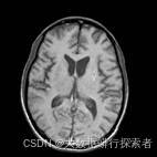 论文《基于VGG19的CT与MRI图像融合算法研究》-CSDN博客