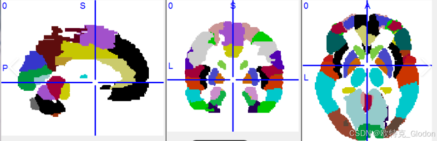 3D医学影像开发＜七＞：利用AAL模板实现脑功能区的自动划分_aal模板脑区-CSDN博客