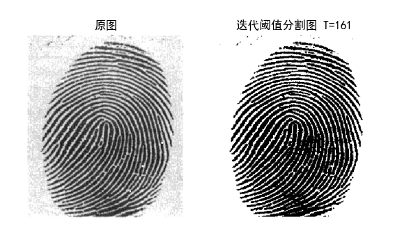 DIP实验五——阈值分割_otsu阈值分割-CSDN博客