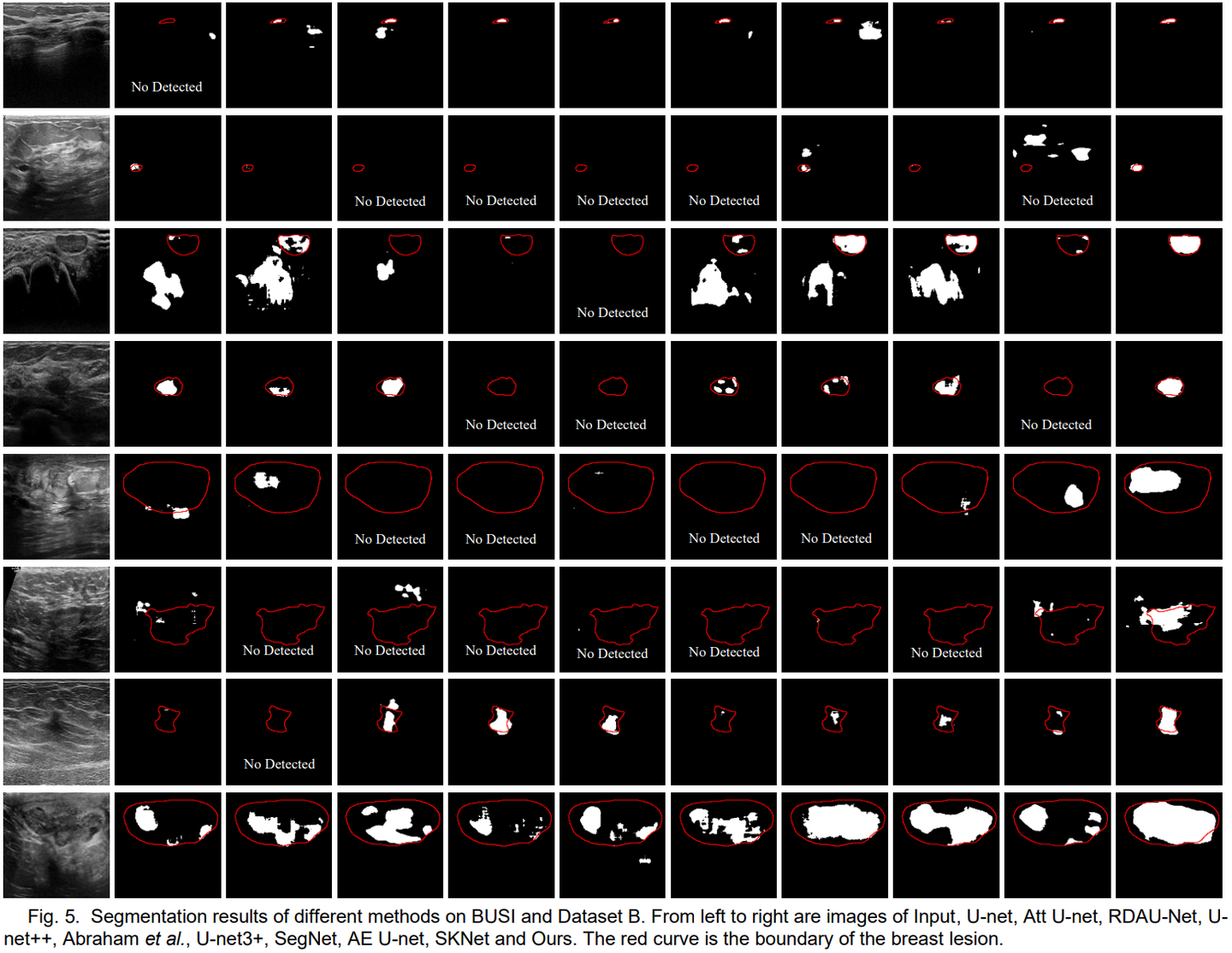 解锁乳腺超声图像分割新利器：AAU-Net 的自适应注意力魔法_aau-net: an adaptive attention u-net for breast le-CSDN博客