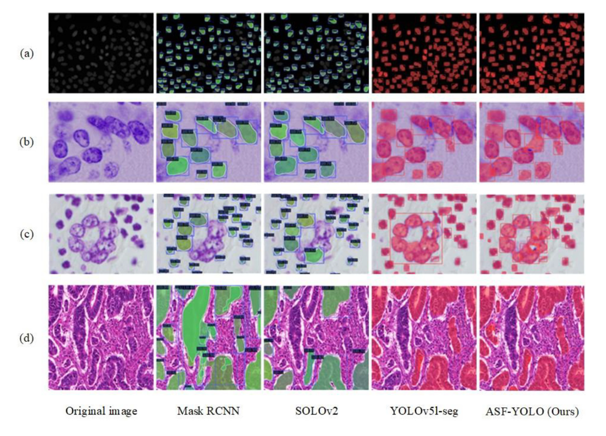 【医学实例分割】ASF-YOLO：一种用于细胞实例分割的具有注意力尺度序列融合的新型YOLO模型-CSDN博客