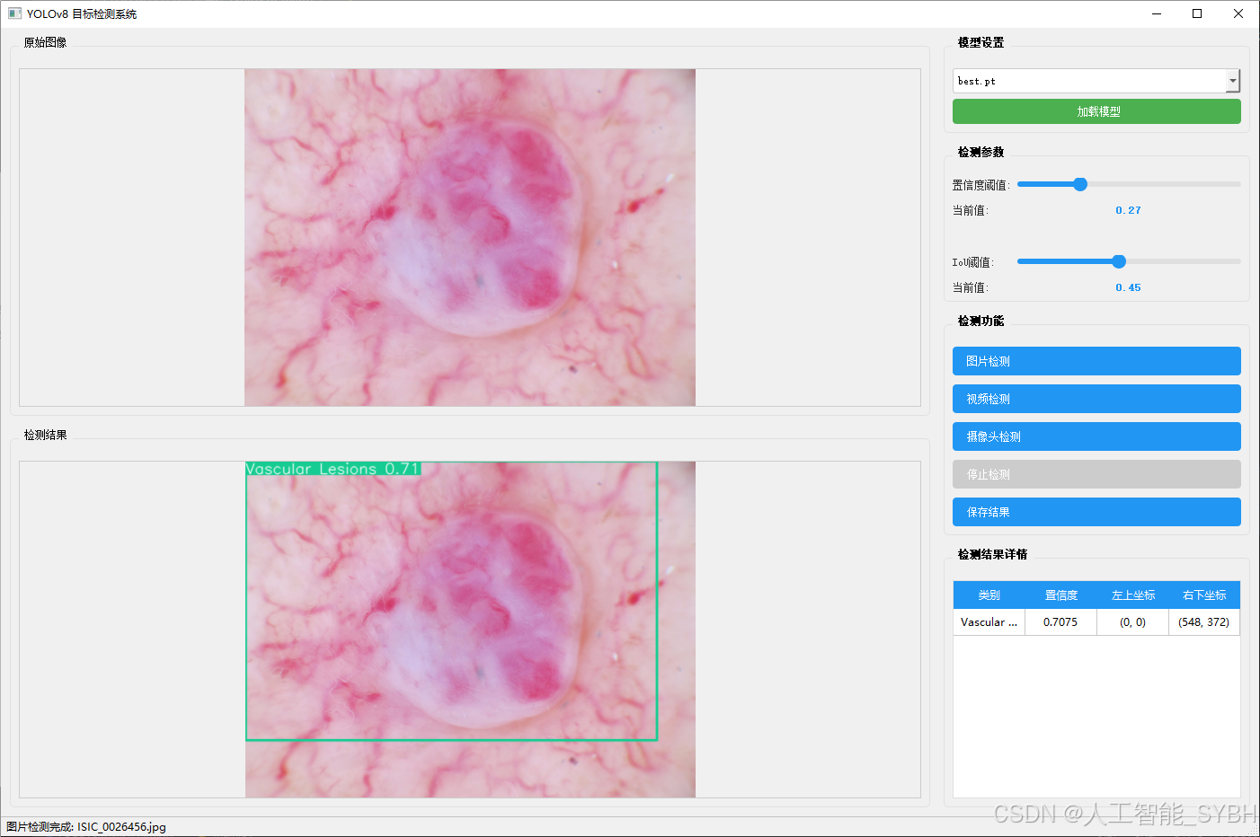 基于YOLOv8深度学习的皮肤病检测系统（YOLOv8+YOLO数据集+UI界面+Python项目源码+模型）_yolov8 皮肤病-CSDN博客