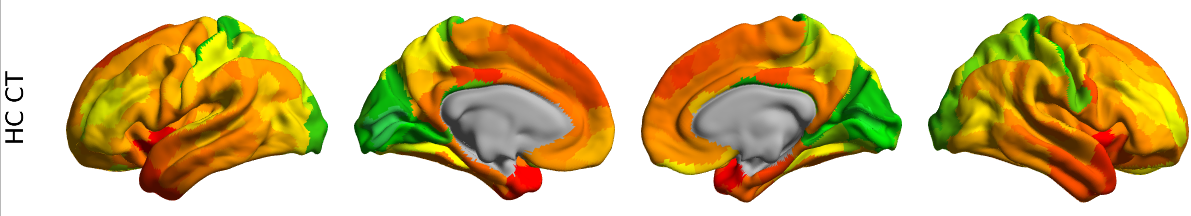 【脑皮层Matlab作图】如何使用matlab绘制皮层图像-CSDN博客
