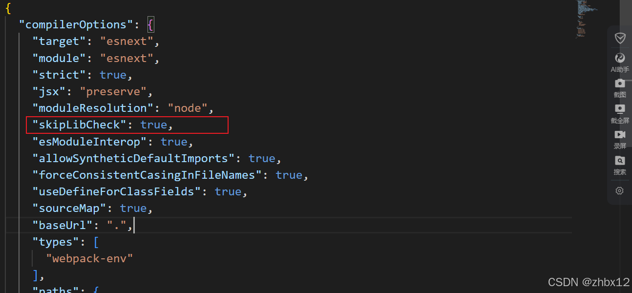如何在Vue项目中集成并使用TypeScript_vue typescript-CSDN博客