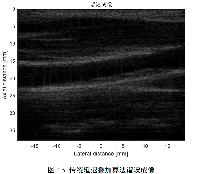 Matlab基于延迟叠加算法的聚焦超声波束合成_circshift 延时叠加-CSDN博客