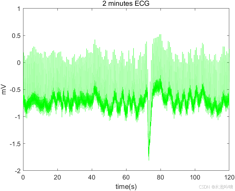 信号与系统工程实践--ECG（心电图）_ecg信号-CSDN博客