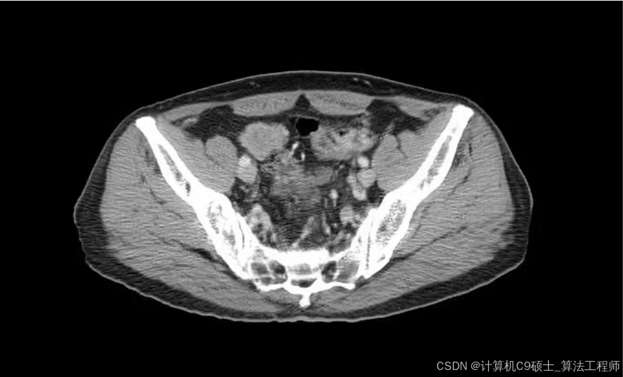 采用深度学习使用卷积神经网络（cnn）选择efficientnet预训练模型进行微调医疗图像数据集，处理训练应用ct，x光射线，核磁共振的主要疾病医疗图像数据集 Csdn博客