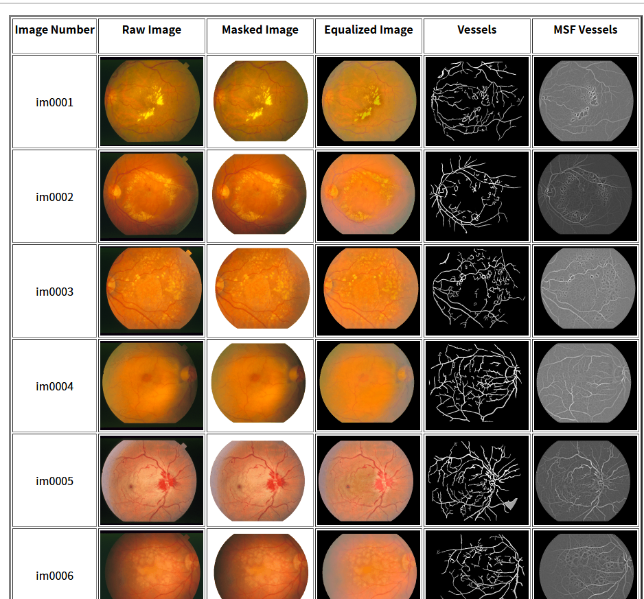 视网膜血管分割数据集（DRIVE数据集，STARE数据集，REFUGE数据集，CHASE_DB1数据集，DiaRetDB1数据集）-CSDN博客