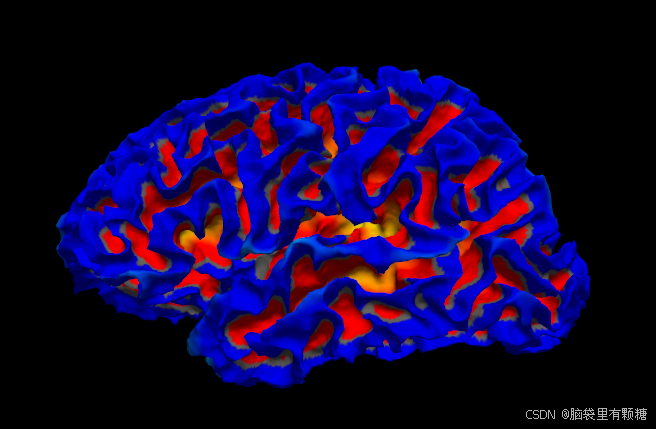 Workbench View 可视化(FreeSurfer2Workbench)问题小结_freesurfer 可视化-CSDN博客