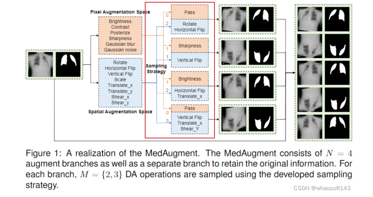 Medaugment：基于医学图像的数据增强方法（针对分类问题及图像分割问题）医学图像分割中数据增强 Csdn博客