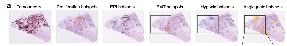 空转复习---空间转录组hotspot_spottedpy-CSDN博客