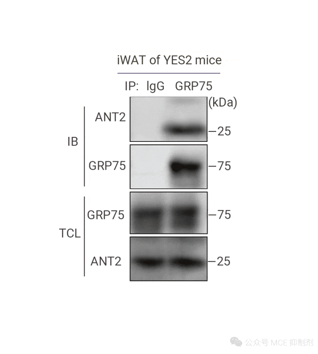 Co-IP 实验不踩坑：蛋白 “拉下场“ 的秘密！揭秘Co-IP实验操作技巧_ha磁珠做ip时igg用什么属性-CSDN博客