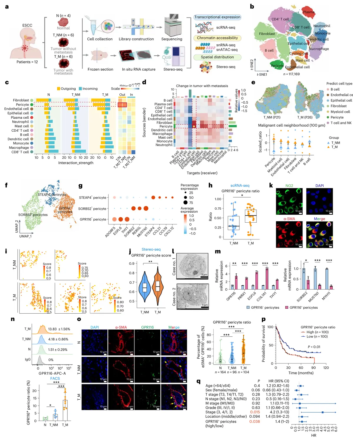 单细胞空间--食管鳞状细胞癌的单细胞多组学与空间分析揭示GPR116+周细胞在癌症转移中的免疫抑制功能-CSDN博客