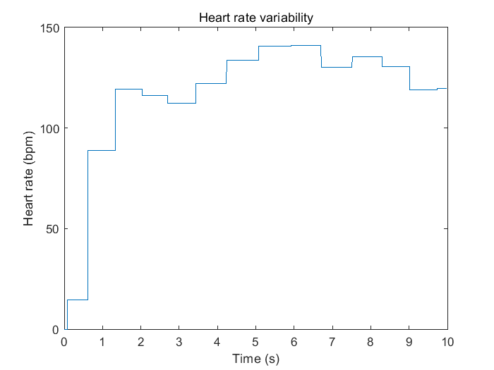 【心率检测】 心电信号（ECG）处理从原始 ECG 数据中提取 R 波峰值、计算心率（HR）与心率变异性（HRV）Matlab代码-CSDN博客