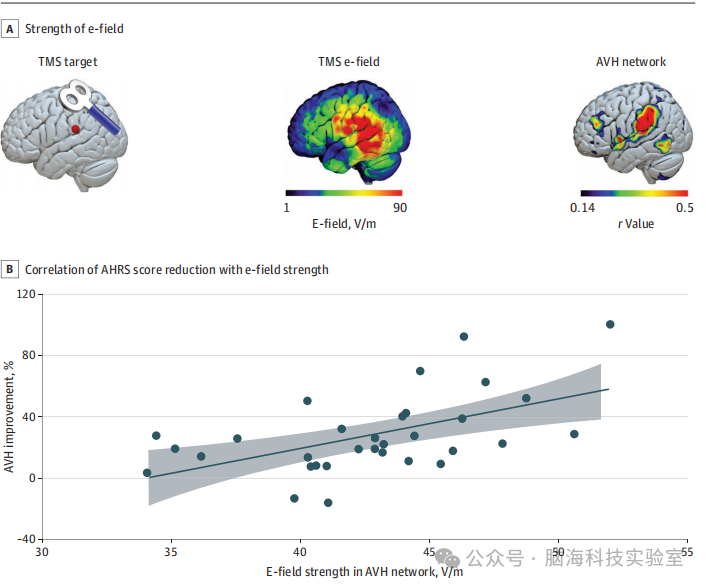 往期精彩|JAMA Netw. Open：重复经颅磁刺激（rTMS）为精神分裂症患者带来新希望-CSDN博客