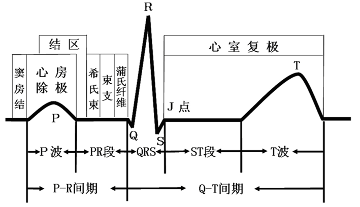 一文详解ECG心电波形之QT间期分析_qt间期怎么测量-CSDN博客