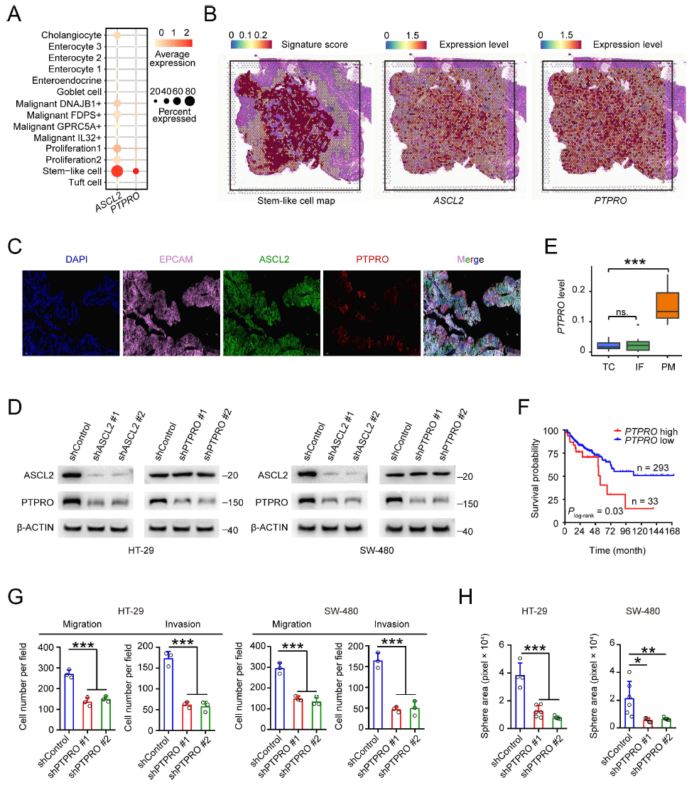 GUT (IF: 23.0) | 单细胞+空间转录组破译结直肠癌异质肿瘤干细胞器官特异性转移机制_结肠癌转移 干性 单细胞测序-CSDN博客