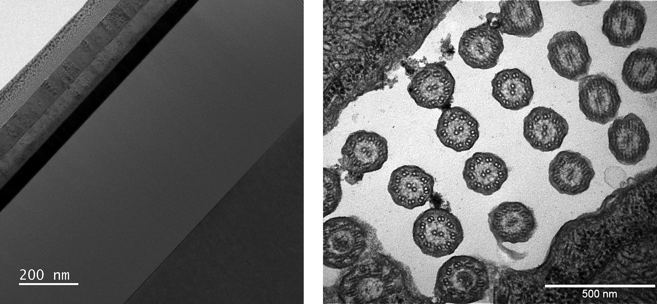 技术解读专栏|透射电子显微镜（TEM）_tem 影像和衍射模式-CSDN博客