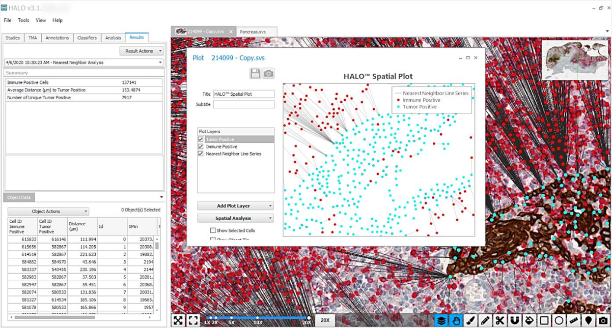 Abics Multicolor Analysis Service - HALO Pathology Image Analysis-CSDN博客