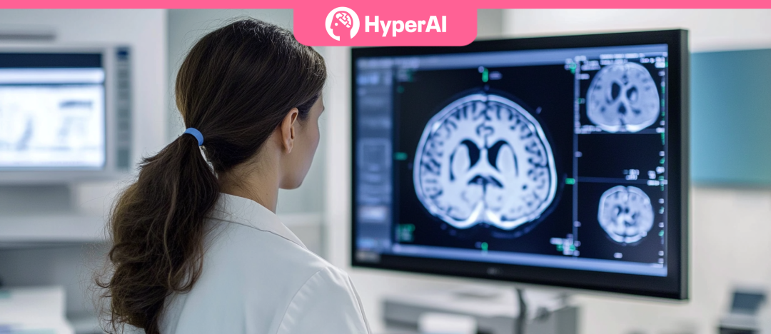 最大化挖掘临床MRI数据价值，UCL团队提出MindGlide模型，实现多发性硬化症病变量化-CSDN博客