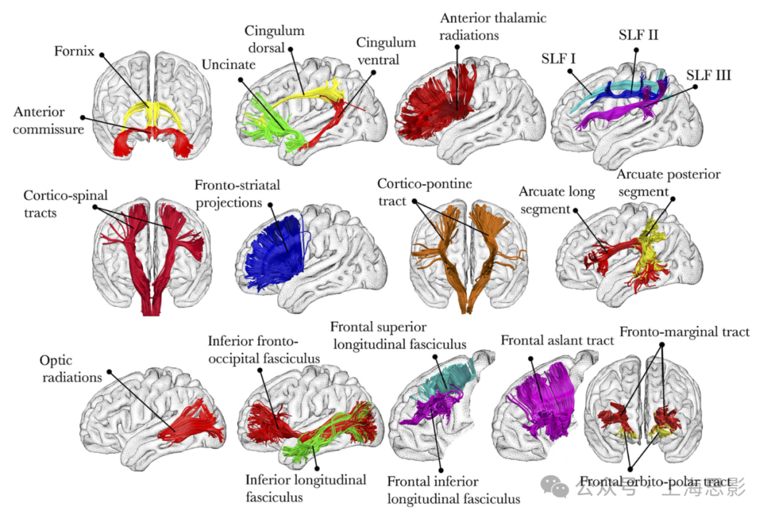 利用开放的神经影像数据集来理解大脑_ppmi数据集-CSDN博客