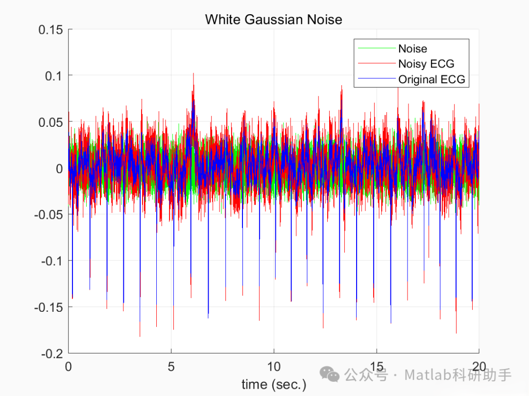 ECG信号处理——包括基本波检测、信号去噪、信号重建度量附Matlab代码_matlab ecg数据-CSDN博客