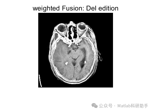 【图像融合】用于图像融合方法、客观评估指标、弗里德曼(Friedman)统计检验及其事后检验研究附Matlab代码-CSDN博客