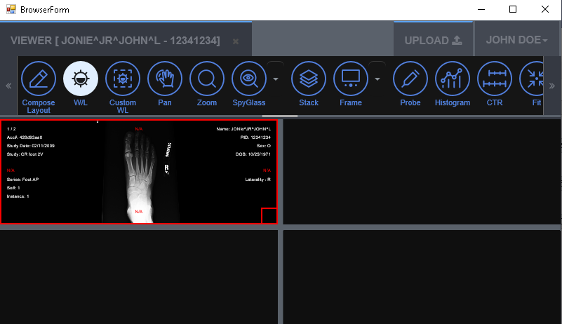 EADTOOLS Medical Web Viewer外部控件演示 - WinForms C#-CSDN博客