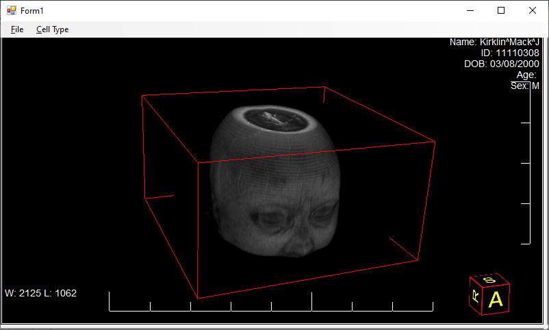 LEADTOOLS将DICOM图像切片加载并显示为3D对象_medicalviewercell cell 释放-CSDN博客