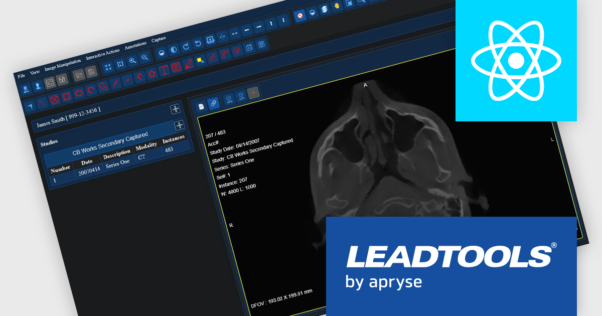 利用模块化设计增强医学成像-LEADTOOLS Medical Web Viewer_react dicom-CSDN博客