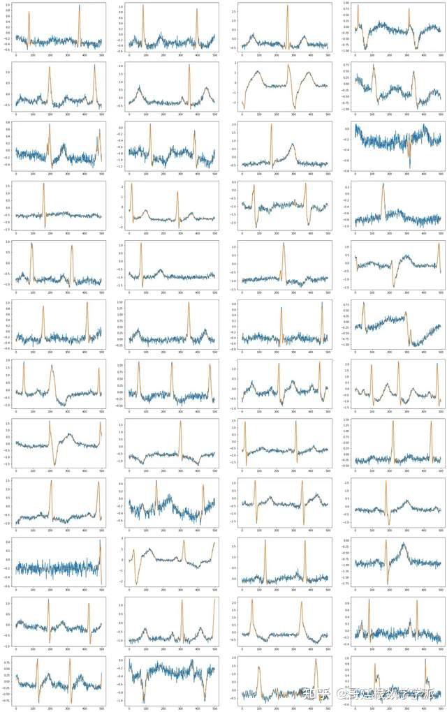 几种心电信号ECG降噪方法（Python）_ecg信号滤除50hz的python代码-CSDN博客